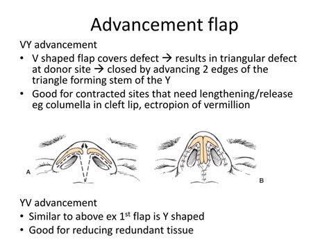Ppt Cummings Chap 24 Reconstruction Of Facial Defects Powerpoint