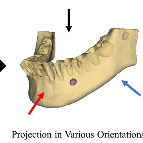 Illustration Of Mandibular Centerline Extraction Download Scientific