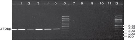 Pcr Amplification Of Sex Specific Ecor1 Fragment Sequence Ee06 Using