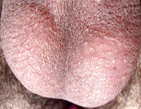 Ah Queue Coucou Porn Pictures Xxx Photos Sex Images 2114876 Pictoa