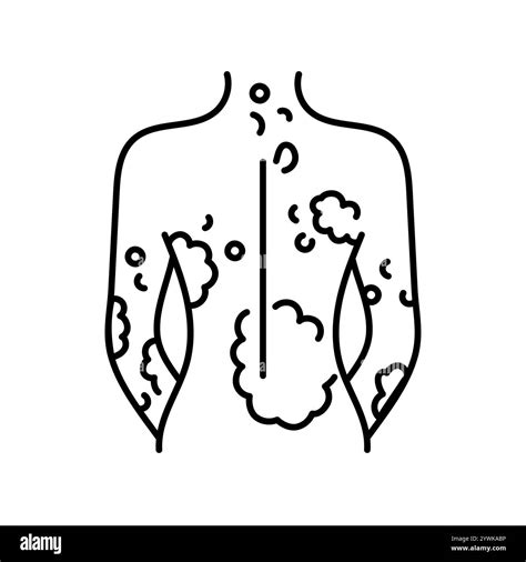 Psoriasis Color Line Icon Autoimmune Diseases Vector Isolated Element Editable Stroke Stock