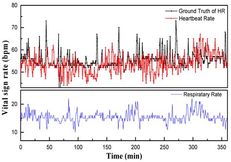 Sensors Free Full Text Noncontact Sleeping Heartrate Monitoring