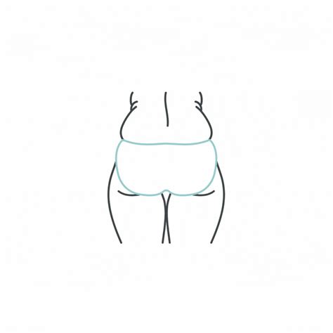 Liposuction Faq Anne Peled Md