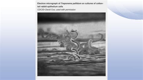 Syphilis Disease Editedpptx Bacterium Treponema Pallidum Ppt