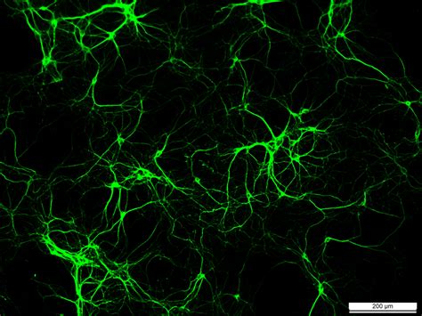 Neurons Only Have One Axon But Why I Can See More Than One Branches