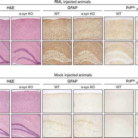 Normal And Abnormal Form Of Prion Protein Normal Prion Protein Has