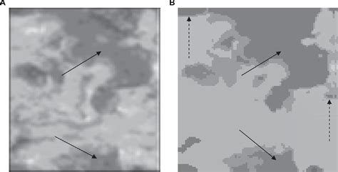 Figure 4 From An Unsupervised Strategy For Biomedical Image