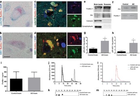 Ad Brain Exosomes Are Enriched With Oaβ Ad Brain Sections From