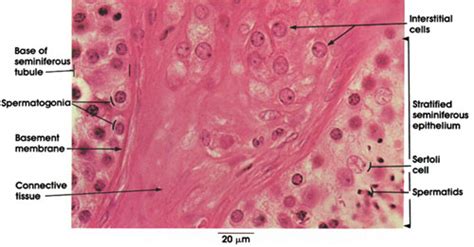 Plate 14268 Interstitial Cells