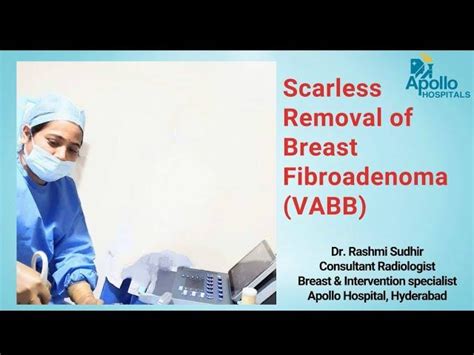 Scarless Removal Of Breast Fibroadenoma Vacuumassistedbreastbiopsy