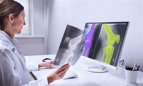 The Future Of Healthcare How Ai Driven Data Annotation Is Transforming Medical Industry Mindy