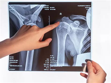 Role Of Medical Annotation In Radiology 1 Diagnosis Guide