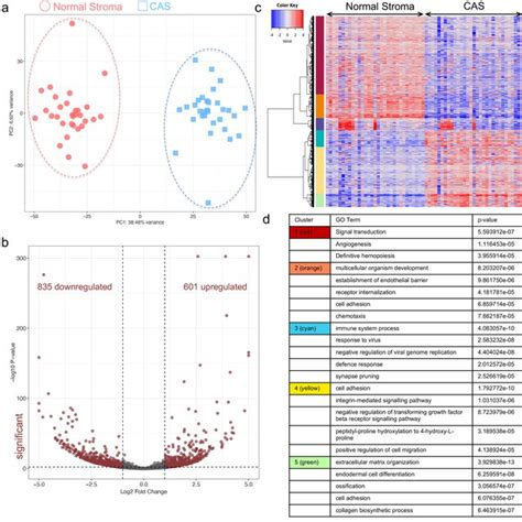 Transcriptomic Profiling Of Matched CAS And Normal Stroma From 31 Download Scientific Diagram