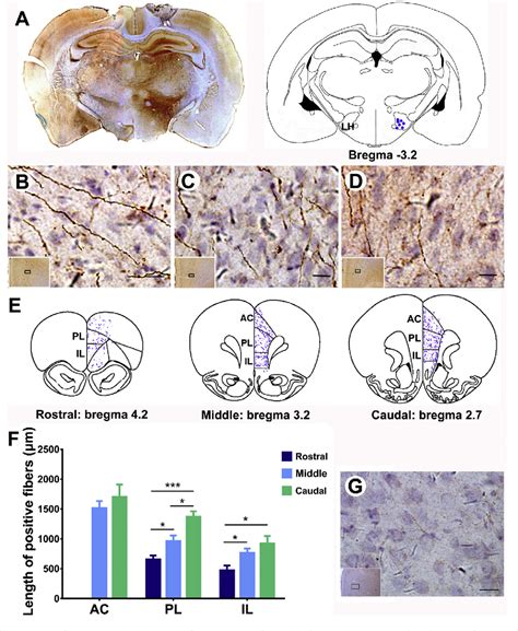 Figure 1 From Orexin Neurons In The Lateral Hypothalamus Project To The