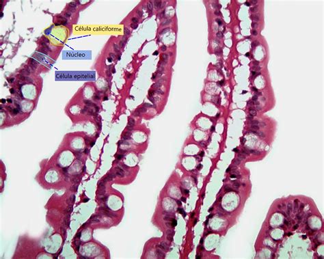 Mucosa De Intestino Delgado Epitelio Cilíndrico Simple Con