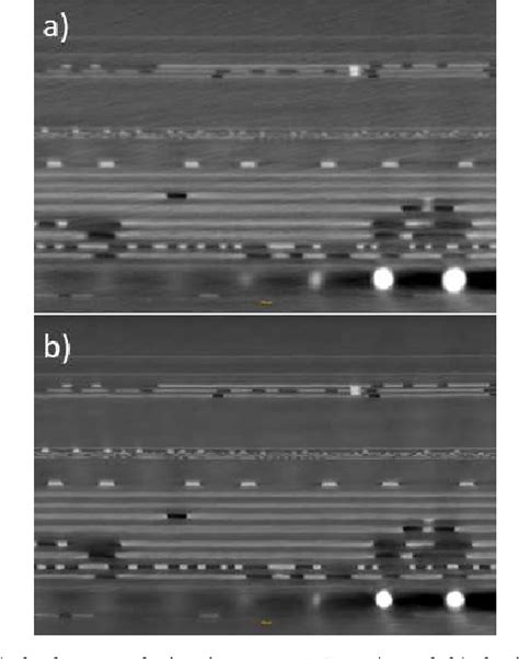 Figure 3 From A Deep Learning Reconstruction Technique And Workflow To Enhance 3d X Ray Imaging