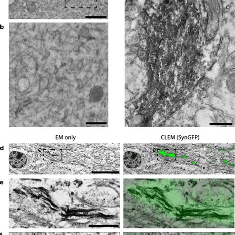 Electron Micrographs Show Fibrillar Structures That Co Localize With Download Scientific