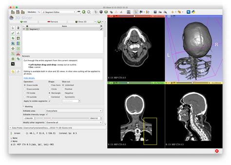 new user stuck getting segment editor tools to work support 3d