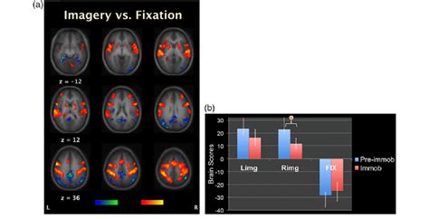 Fmri Whole Brain Results A A Pattern Of Whole Brain Activity Download Scientific Diagram