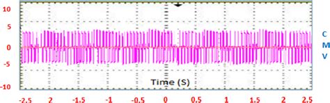 Common Mode Voltage Of The Proposed Method Download Scientific Diagram