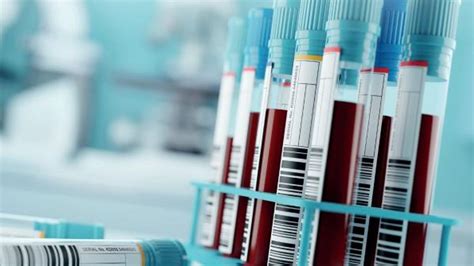 Development Of A Targeted Plasma Quantitation Assay Using Dia Pasef Technology Networks