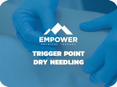 Trigger Point Dry Needling Empower Physical Therapy