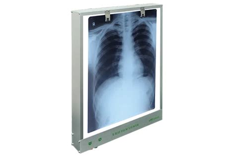 Invoke Medical System Private Limited