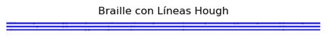 Python Recognize Horizontal And Vertical Lines For Braille Characters Segmentation Stack