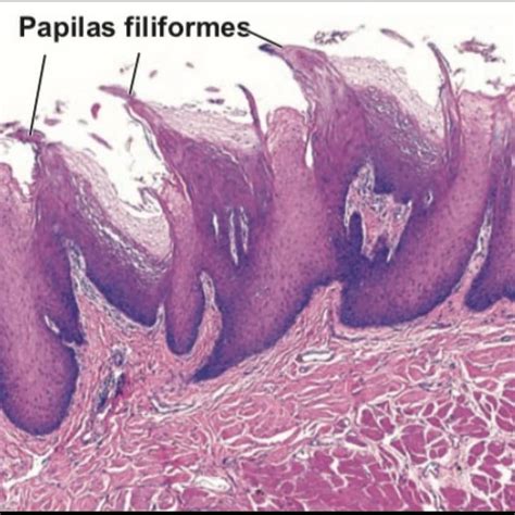 Papilas Filiformes Brancas