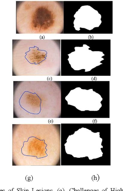 Figure 1 From Skin Disease Classification Using Hybrid Ai Based