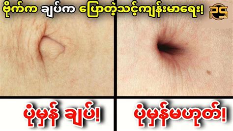 သင့်ခန္ဓာကိုယ်ကပြောပြနေတဲ့ သင့်အကြောင်း ၁၀ ခု 😱😱😱 Youtube