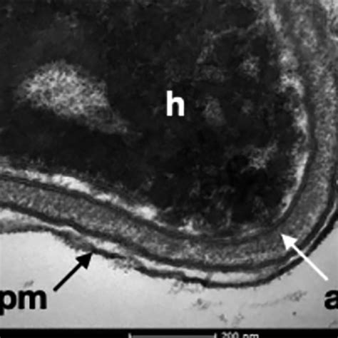 Transmission Electron Microscopy Of Cryopreserved Sperm Structure Download Scientific Diagram