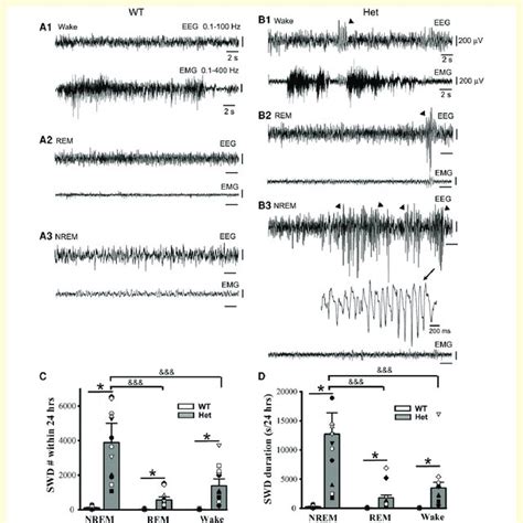 Nrem Rem Sleep Wake States Power Spectrograms Of Eeg Activity And