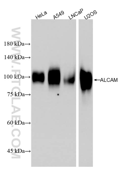 Alcam Antibody 86811 1 Rr Proteintech 武汉三鹰生物技术有限公司