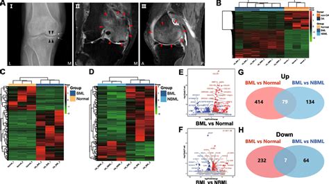 Bulk Rna Sequencing Analysis Of Subchondral Bone Tissues Download