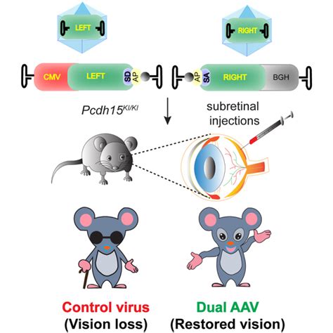 Dual Aav Based Pcdh15 Gene Therapy Achieves Sustained Rescue Of Visual