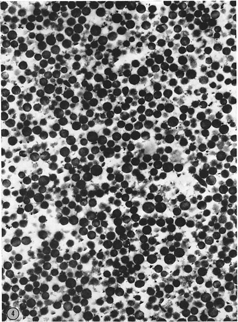 Electronmicrograph Of A Purified Small Granule Fraction X 17600