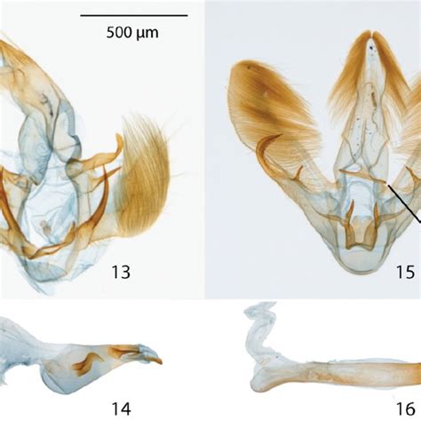 Female Genitalia Of Epsteinius Translucidus And Microleon Longipalpis