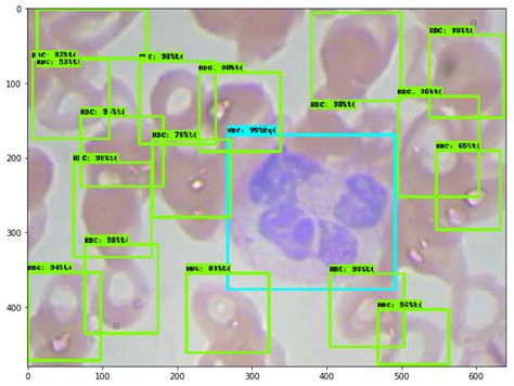 Do Computer Vision Projects Using Deep Learning By Linlin1007 Fiverr