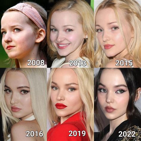 Dove Cameron Plastic Surgery Transformation Over The Years
