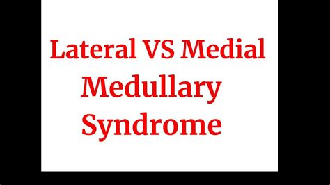 Mnemonico Da Sindrome Medular Lateral