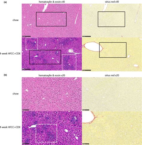 Hematoxylin And Eosin And Sirius Red Stained Liver Section In Mice Fed