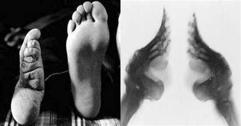 Crazy Things You Didnt Know About Ancient Chinese Foot Binding