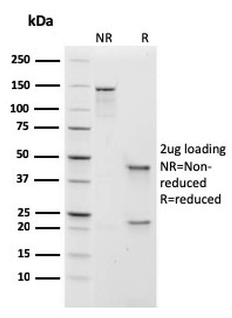 Igm Immunoglobulin Mu Heavy Chain Recombinant Monoclonal Antibody
