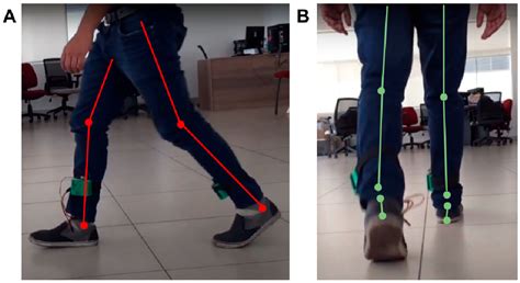 Figure 6 From Development Of 3d Printed Orthopedic Insoles For Patients