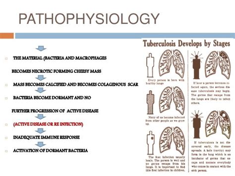 Pulmonary Tuberculosis Tb