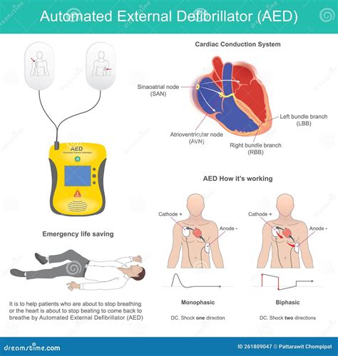 Automated External Defibrillator Stock Vector Illustration Of Life