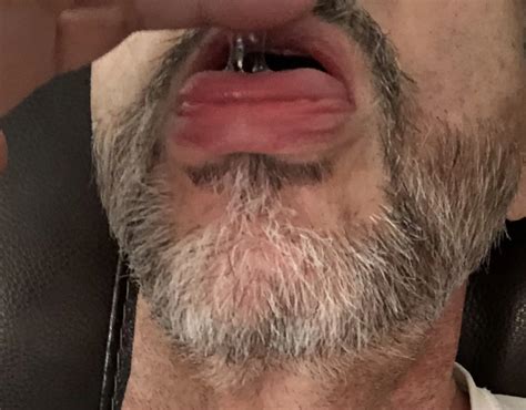 Precum Licking And Savoring😋 5 Pics Xhamster