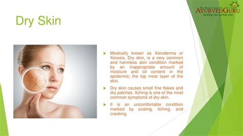 Ppt Dry Skin Treatment Powerpoint Presentation Free Download Id 7494600