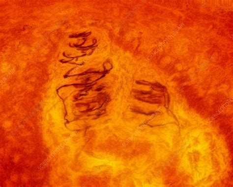 Meissner Corpuscles Light Micrograph Stock Image C051 0144